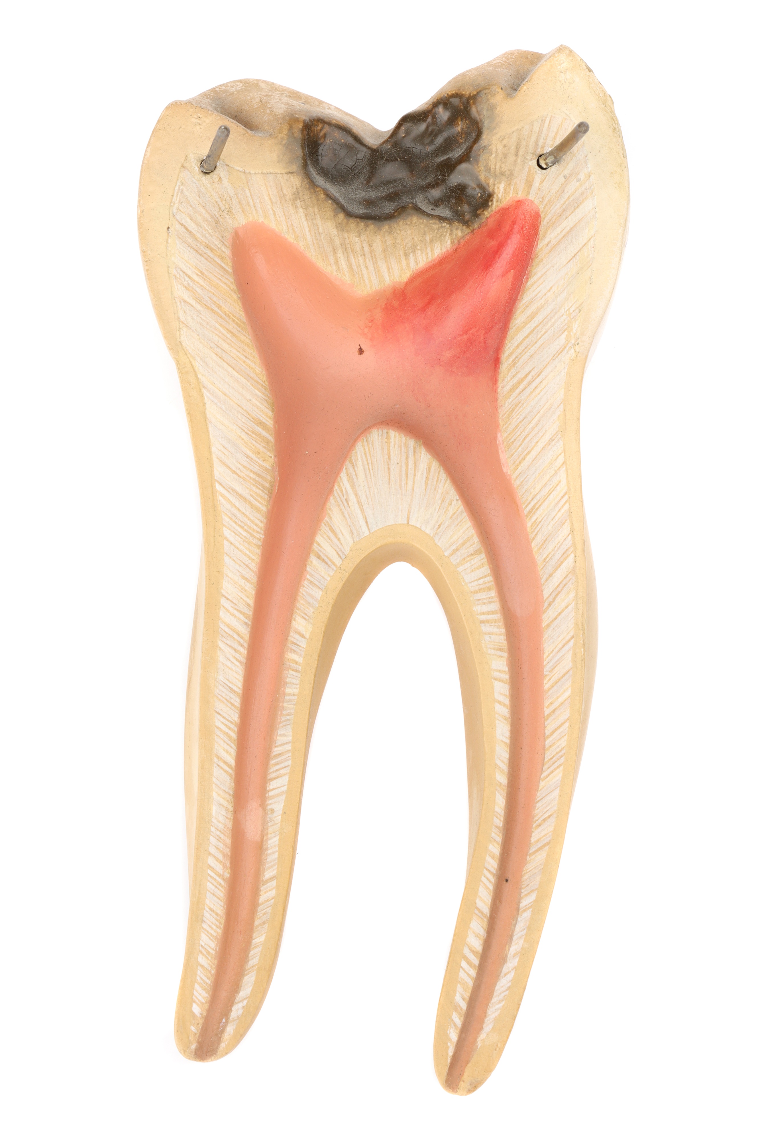 Lot 136 - A Good Didactic Model of a Molar Tooth,