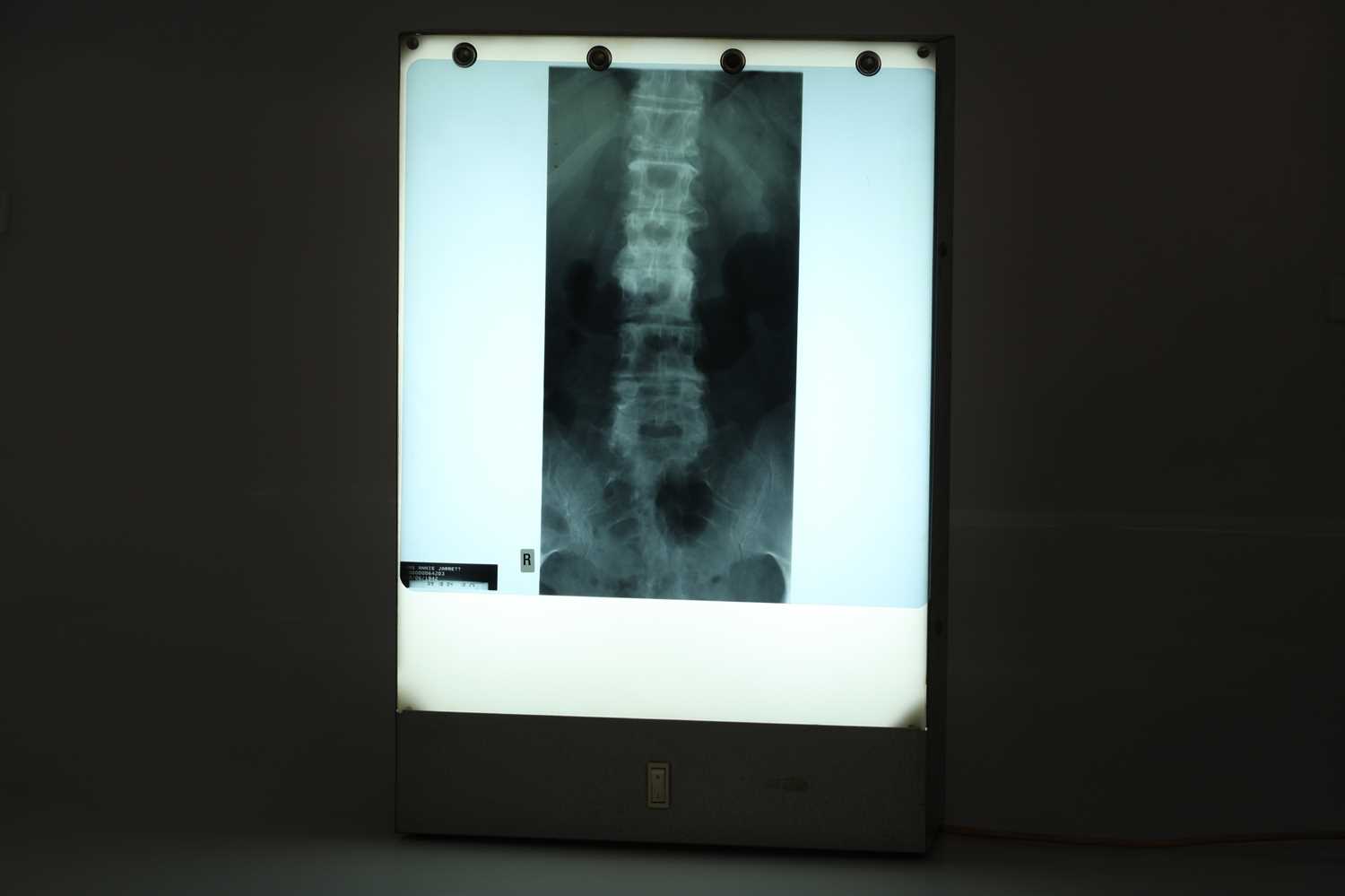 Lot 726 - X-Ray Light Box
