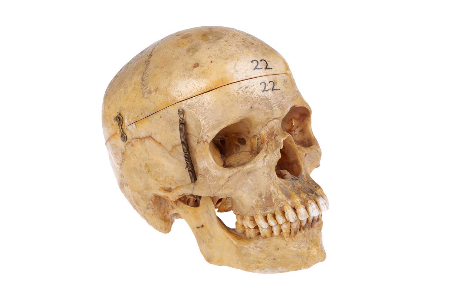 Lot 188 - Victorian Anatomical Human Skull,