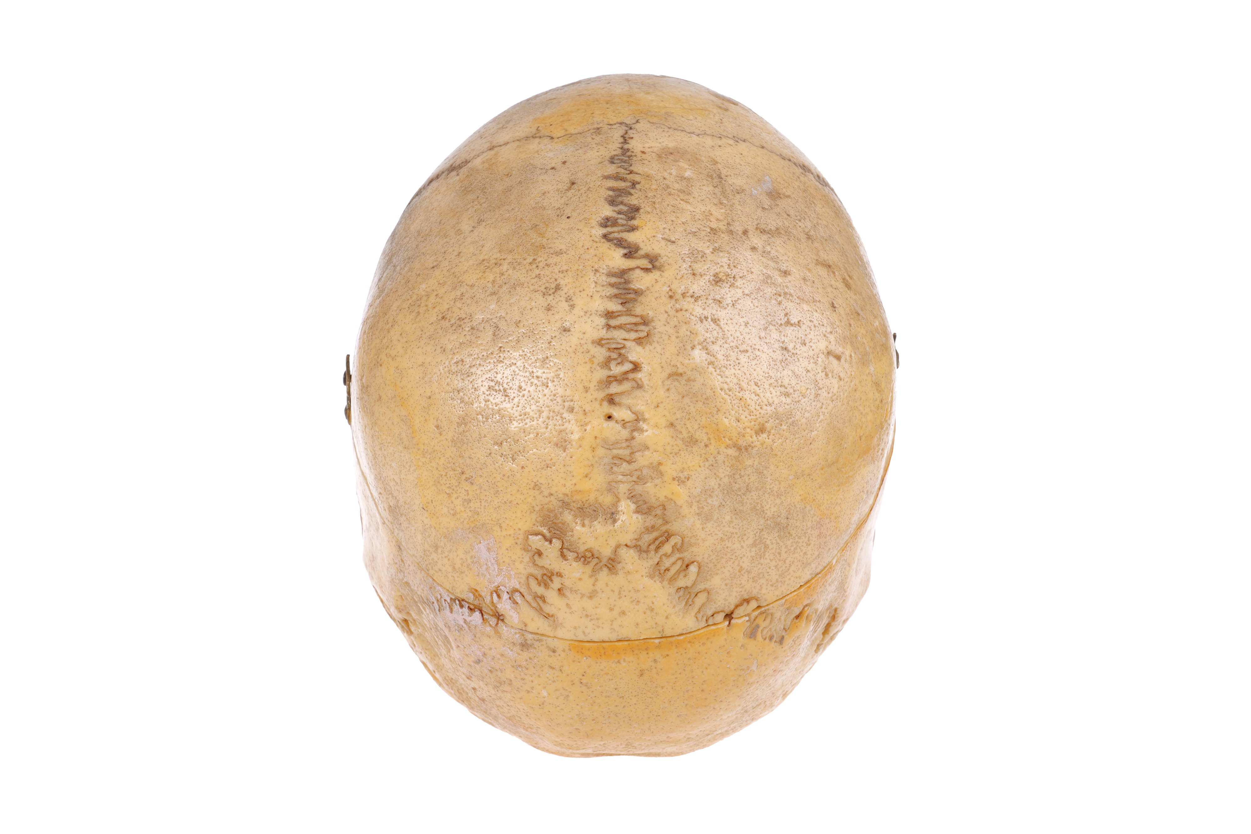 Lot 188 - Victorian Anatomical Human Skull,